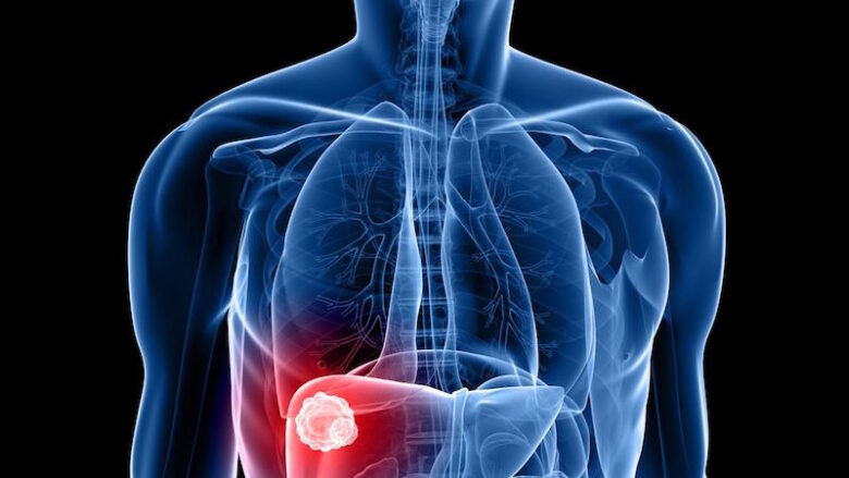 Welk eten is Goed voor je Lever? 10 Gezonde Voedingsmiddelen! - Gezond.be